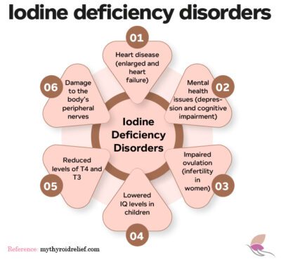 How iodine Deficiency Affects Thyroid Function - My Thyroid Relief